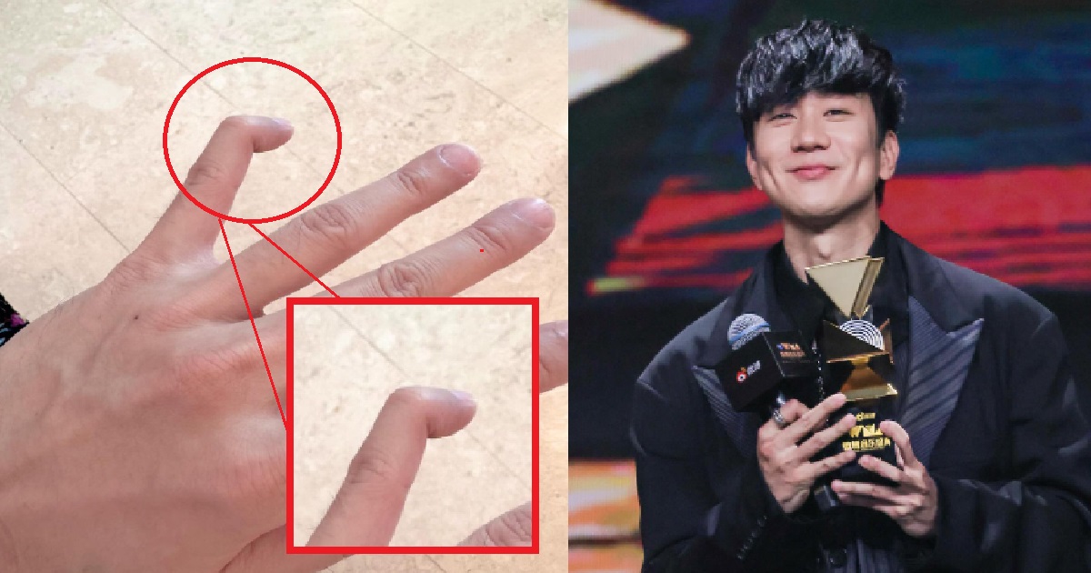 S'PORE SINGER JJ LIN TEARS FINGER TENDON IN FREAK ACCIDENT, CAN'T ...