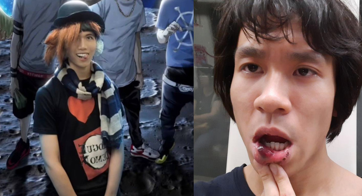 18-Year-Old Charged After Allegedly Assaulting Amos Yee Outside Anime ...