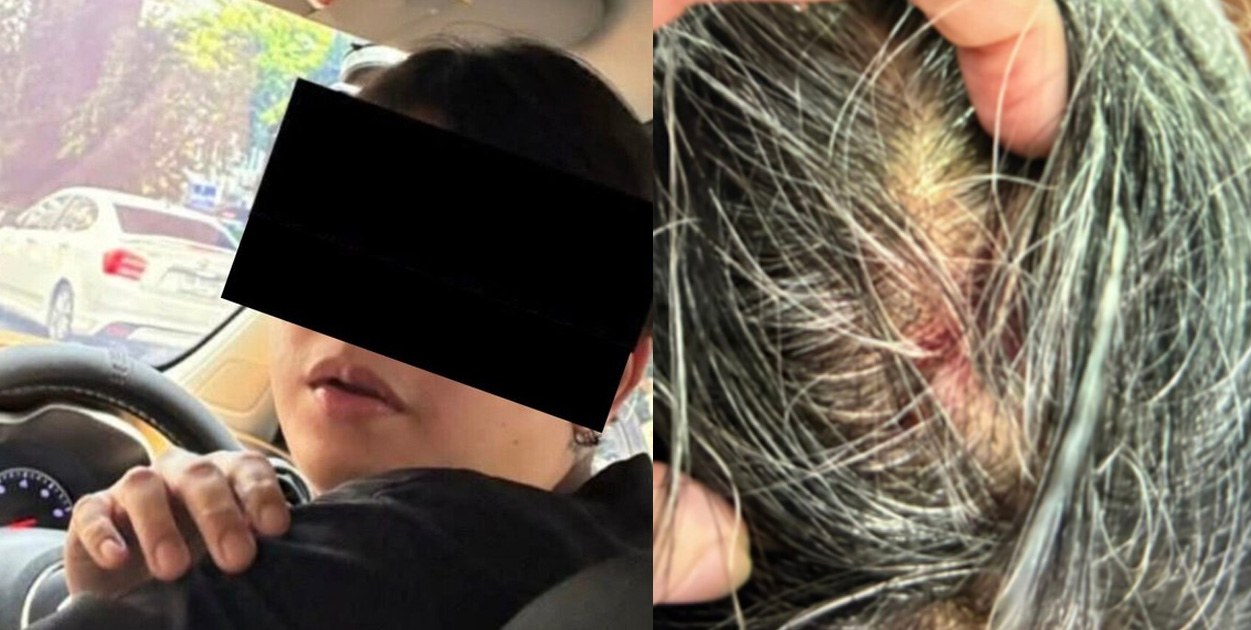 BANGKOK BOLT DRIVER ASSAULTS JAPANESE PASSENGER OVER LOW FARE, THAI ...